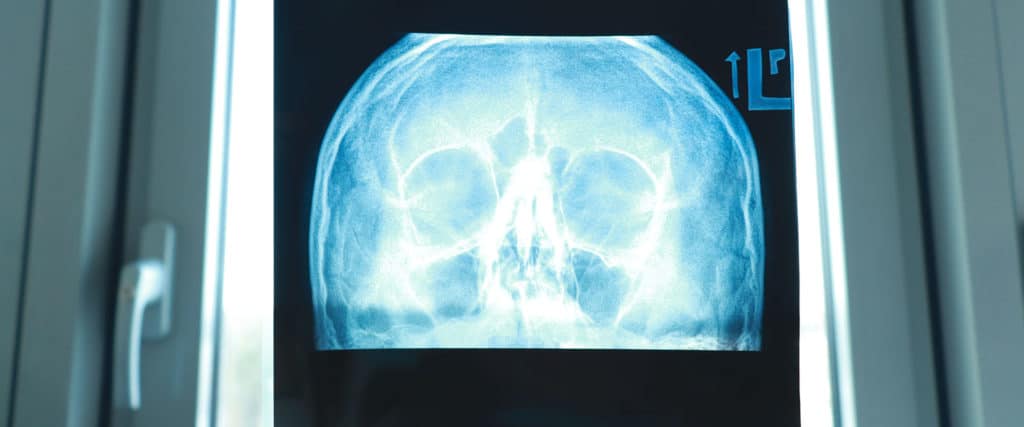 ¿Qué es la órbita del ojo? - Clínica Piñero